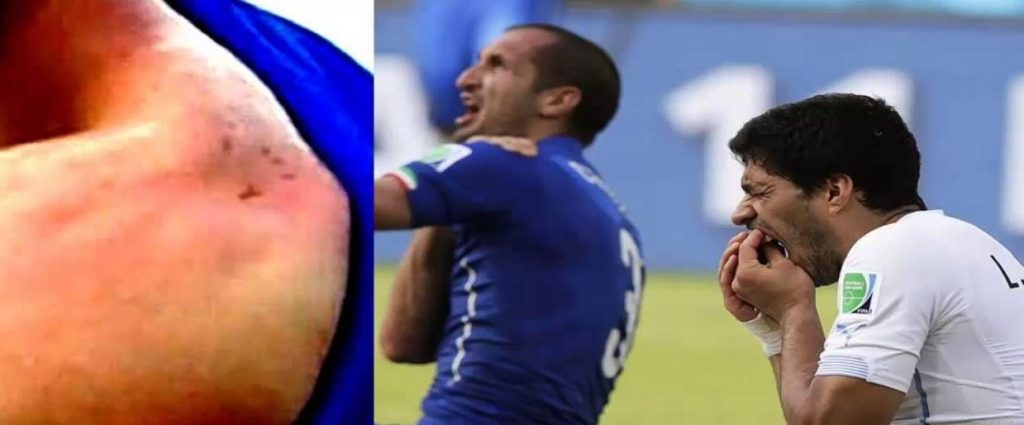 FIFA World Cup: Schedule, Stadiums, Teams, Controversies And More!